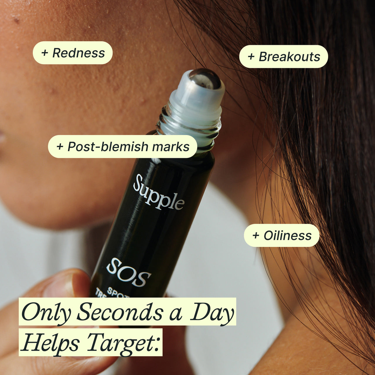 SOS Spot Treatment – Supple Skin Co